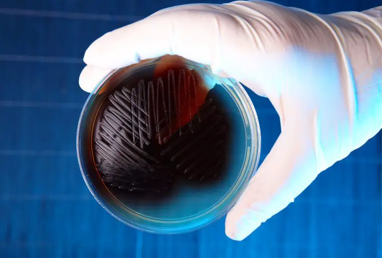 Enterococcus Faecalis Infection | STD.GOV Blog