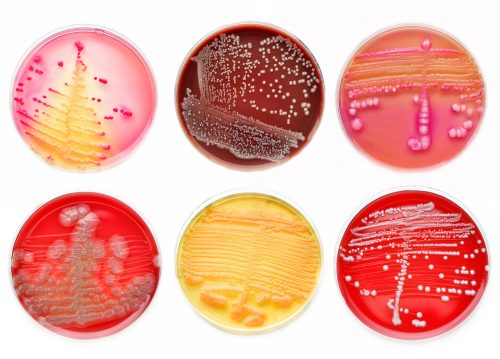 Klebsiella Bacteria | STD.GOV Blog
