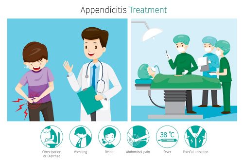 Appendicitis Symptoms In Women | STD.GOV Blog