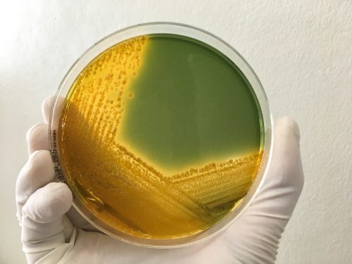 Enterobacter Cloacae: Facts, Symptoms, Treatment | STD.GOV Blog