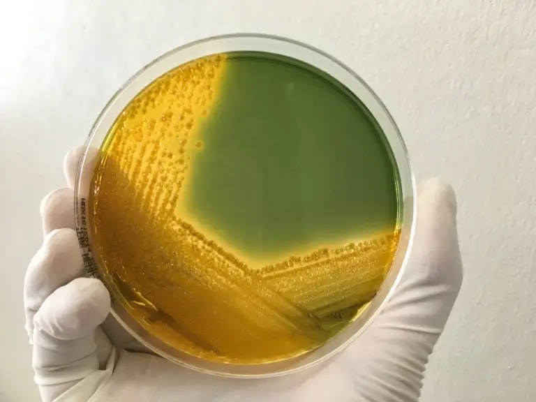 Enterobacter Cloacae: Facts, Symptoms, Treatment | STD.GOV Blog