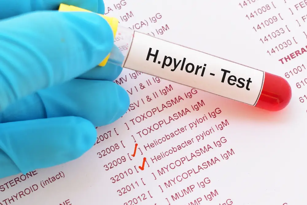 Helicobacter Pylori Transmission Test Diet STD GOV Blog Helicobacter Pylori Transmission Test Diet STD GOV Blog