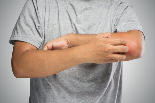 Skin Numbness: Causes, Symptoms, Treatment | STD.GOV Blog