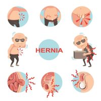 What Are the Causes of Swollen Testicles? | STD.GOV Blog