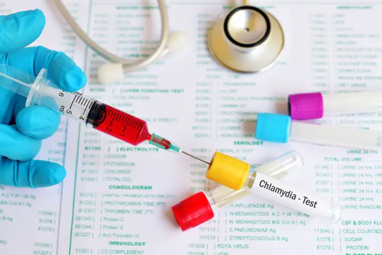 How Doctors Test for STDs | STD.GOV Blog