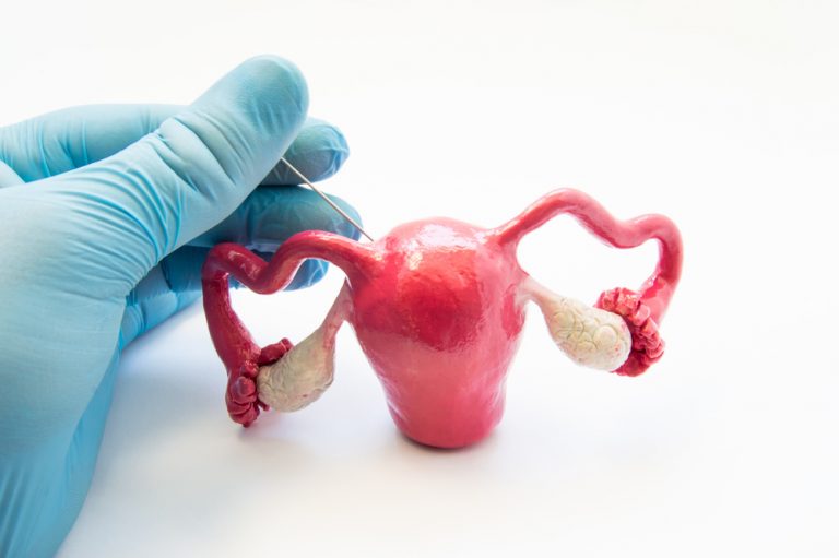 Chronic Endometritis: Causes, Symptoms, Home Remedies | STD.GOV Blog