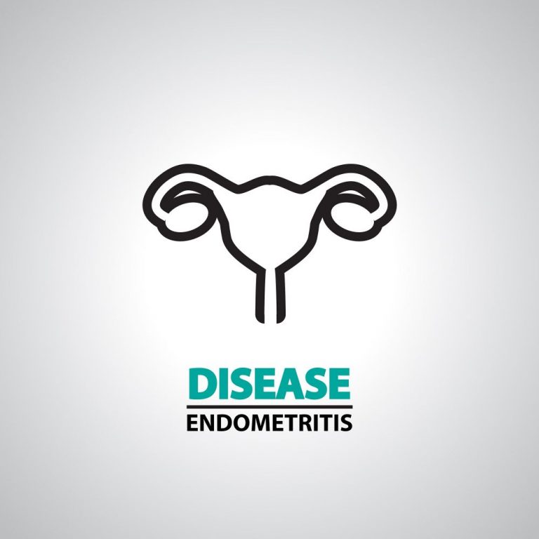 Chronic Endometritis: Causes, Symptoms, Home Remedies | STD.GOV Blog