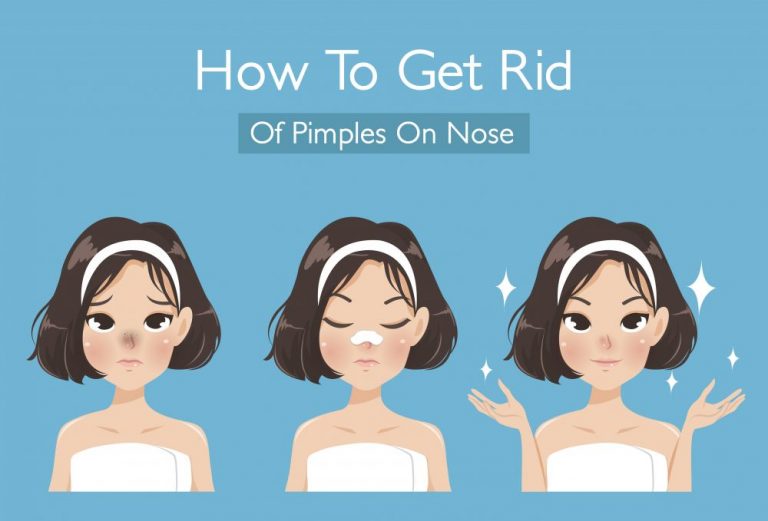 Pimples On Nose: Types, Causes, Treatments, Herbal Remedies | STD.GOV Blog