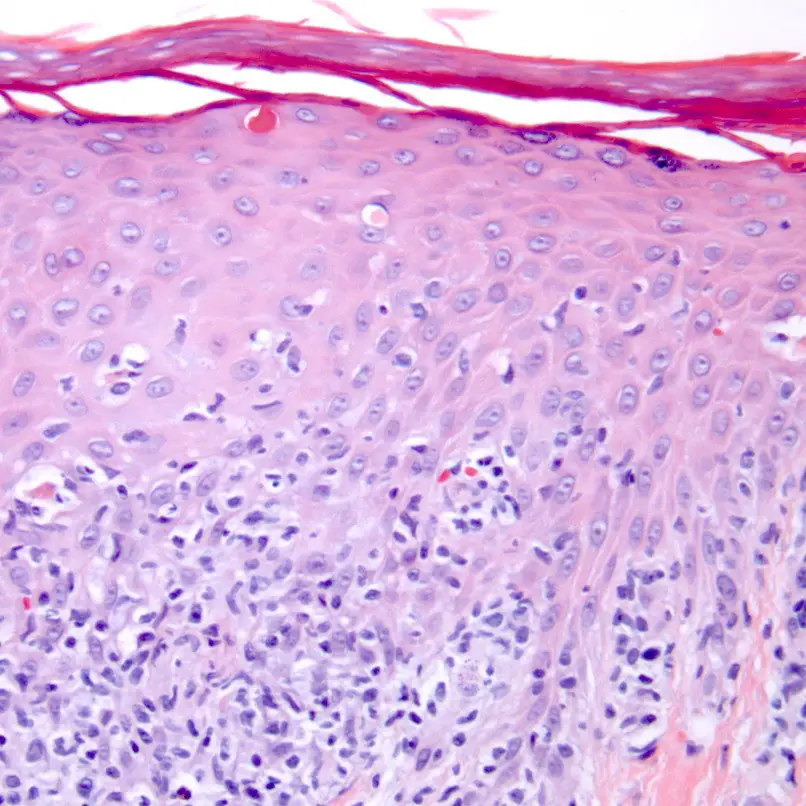 Top 5 Most Dangerous STDs and their Symptoms Top 5 Most Dangerous STDs and their Symptoms