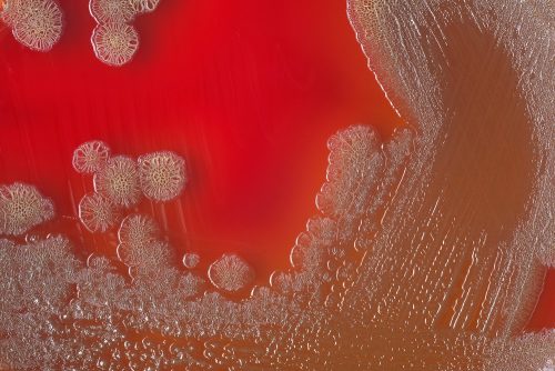 Bacterial Diseases | 12 common diseases that are caused by Bacteria