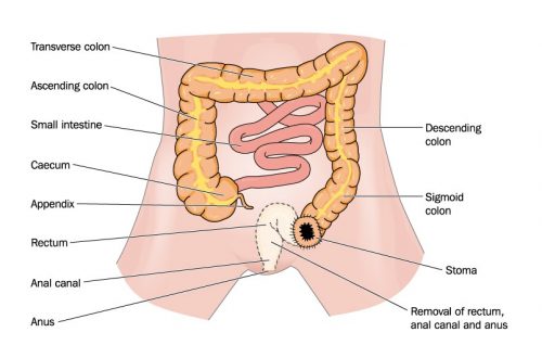 Rectum function | anatomy, disorders, cancer prevention, pictures