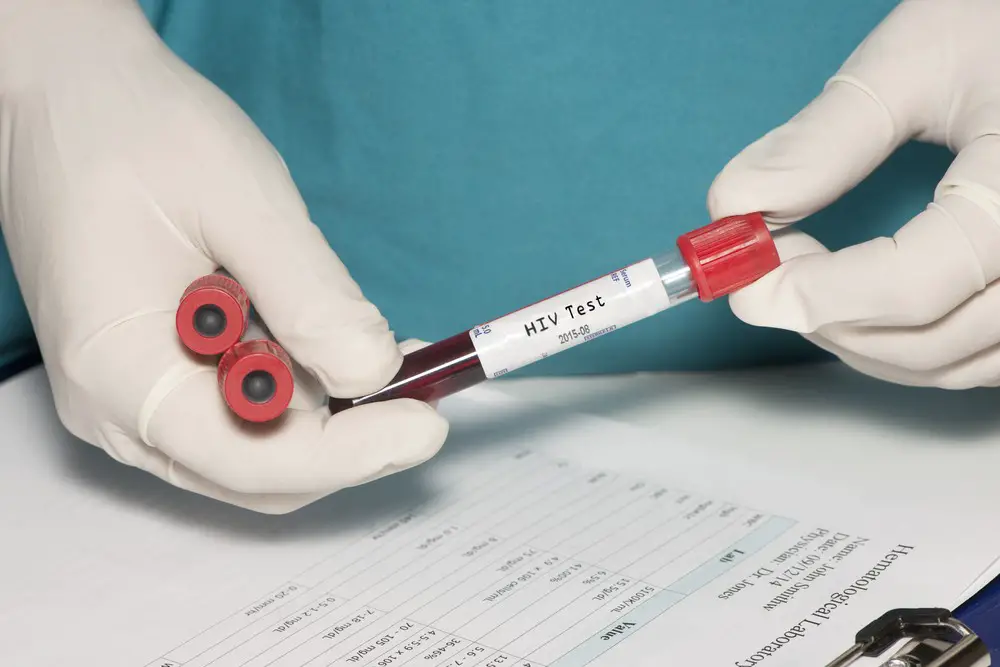 HIV & AIDS Symptoms, Treatment, Testing | STD HIV / AIDS HIV & AIDS Symptoms, Treatment, Testing | STD HIV / AIDS