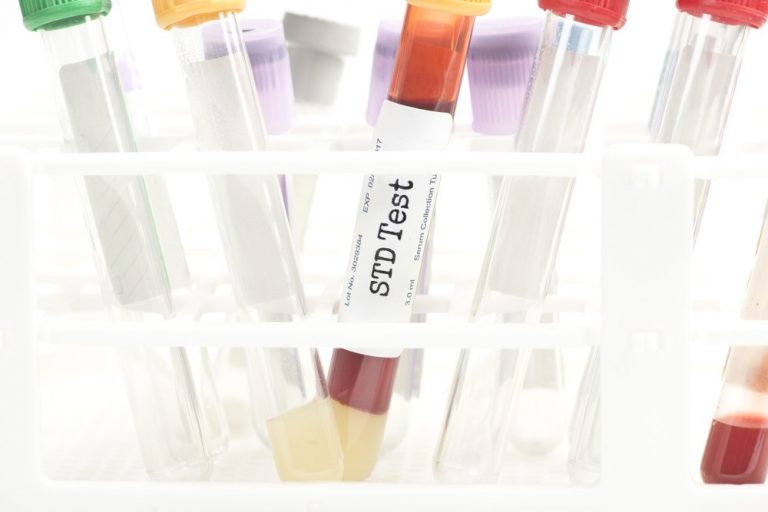 STI & STD Testing Procedure Information for Men and Women