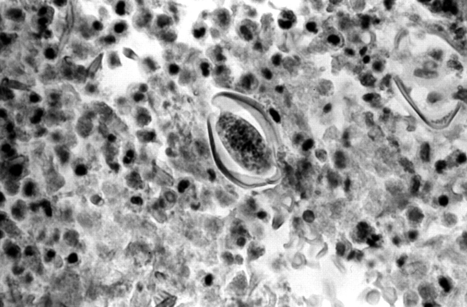 List of all STDs and their Symptoms