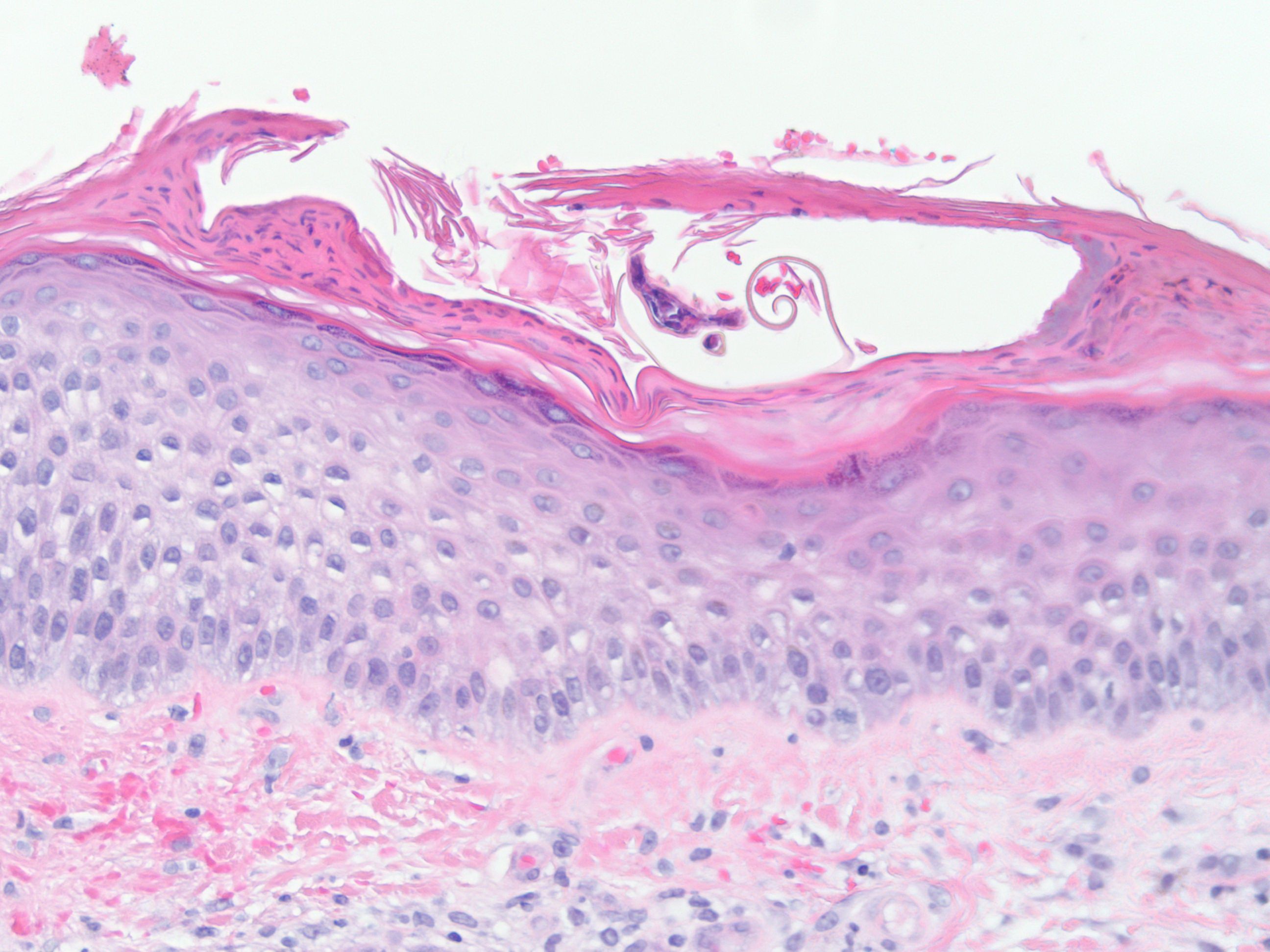 List Of All Stds And Their Symptoms