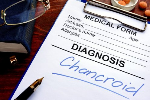 Chancroid Causes, Symptoms, Treatment, Pictures | STD Chancroid