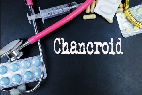 Chancroid Causes, Symptoms, Treatment, Pictures | STD Chancroid