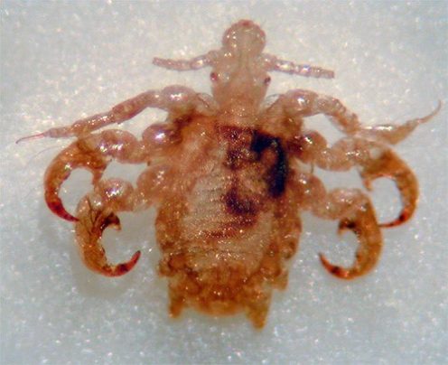 Crabs STD (Pubic lice) detailed Pictures & Images